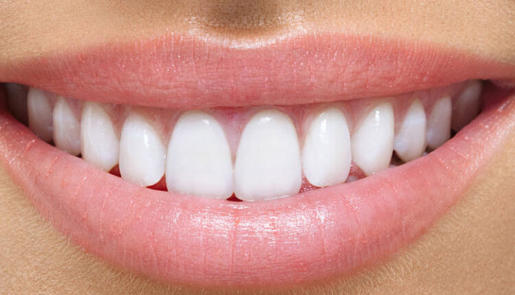 Cirkon koronák – Fogászat Budapesten | Villányi Dent